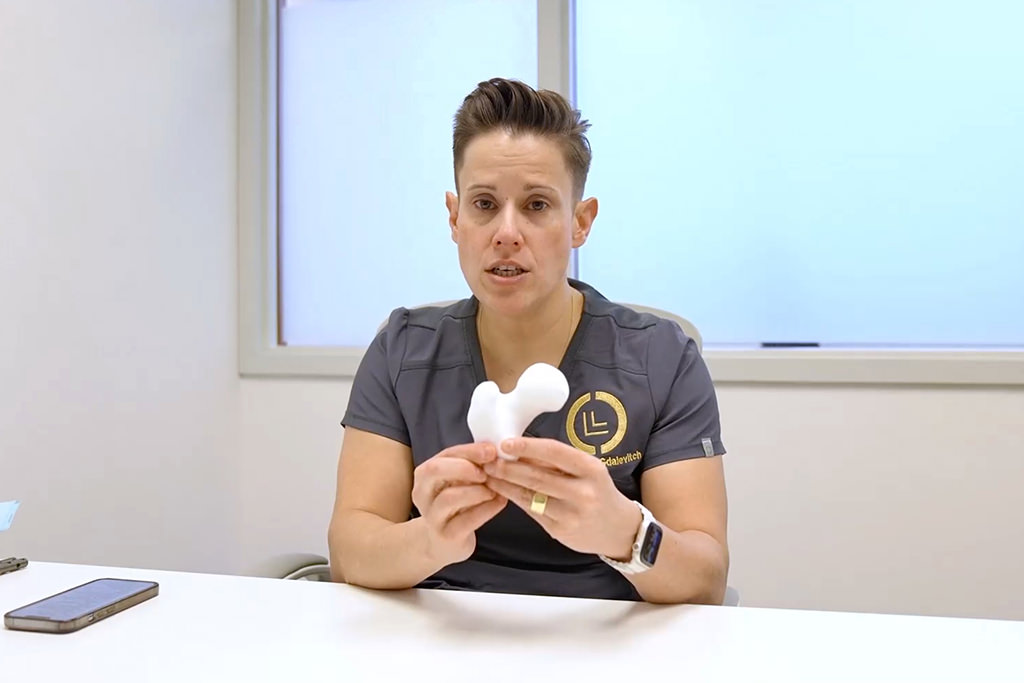 Morscher Osteotomy | CLLC Montréal, Dre Marie Gdalevitch