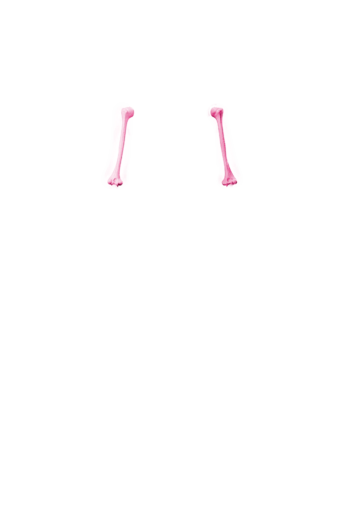 Acute Deformity Correction | CLLC Montréal, Dre Marie Gdalevitch