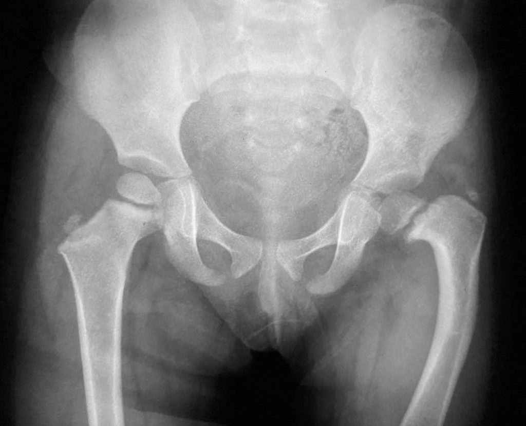 Super hip, knee and ankle | CLLC Montréal, Dre Marie Gdalevitch